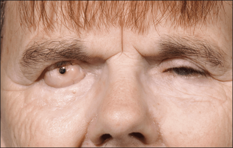 پنج عمل جراحی شگفت‌انگیز که تا کنون انجام شده‌اند! - دکتر مجازی