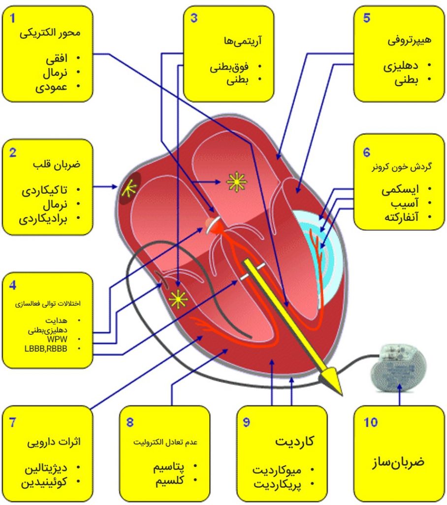 اصول تشخیصی الکتروکاردیوگرام Ecg دکتر مجازی