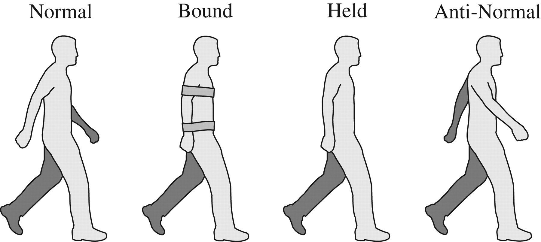 نحوه راه رفتن شما می‌تواند حقایق مهمی را فاش کنند! - دکتر مجازی