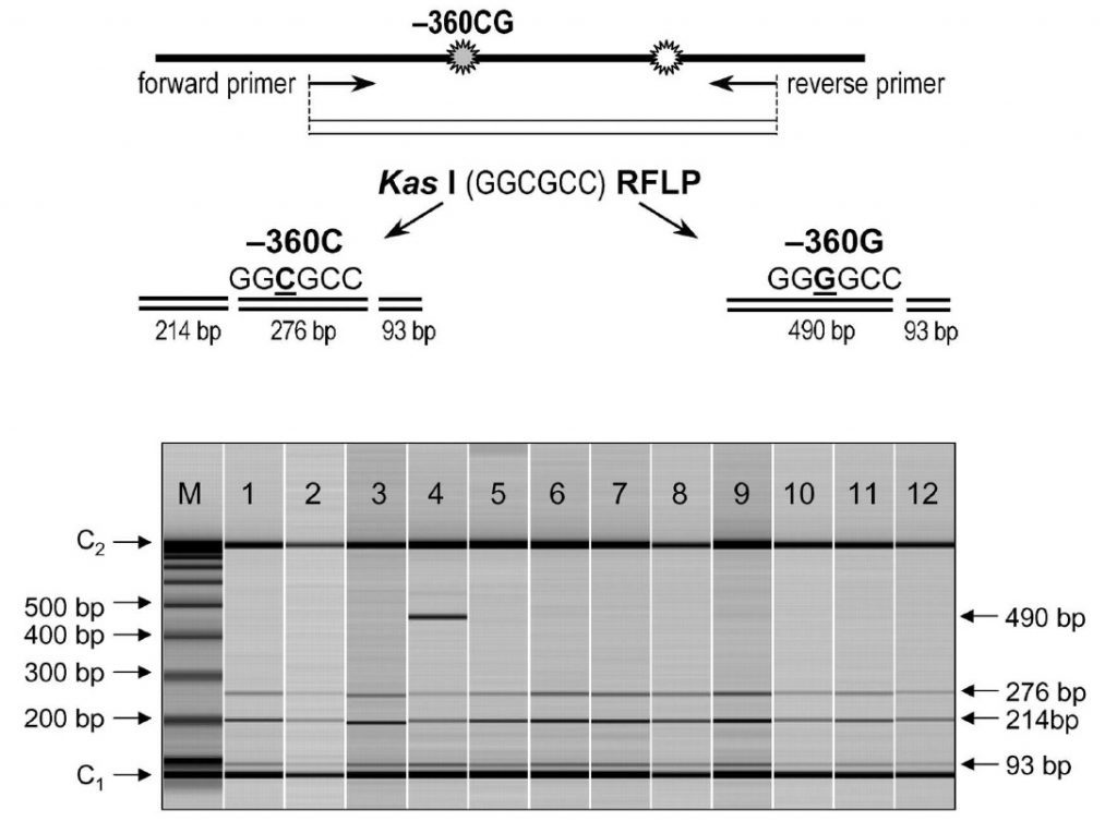 تکنیک PCR-RFLP - دکتر مجازی